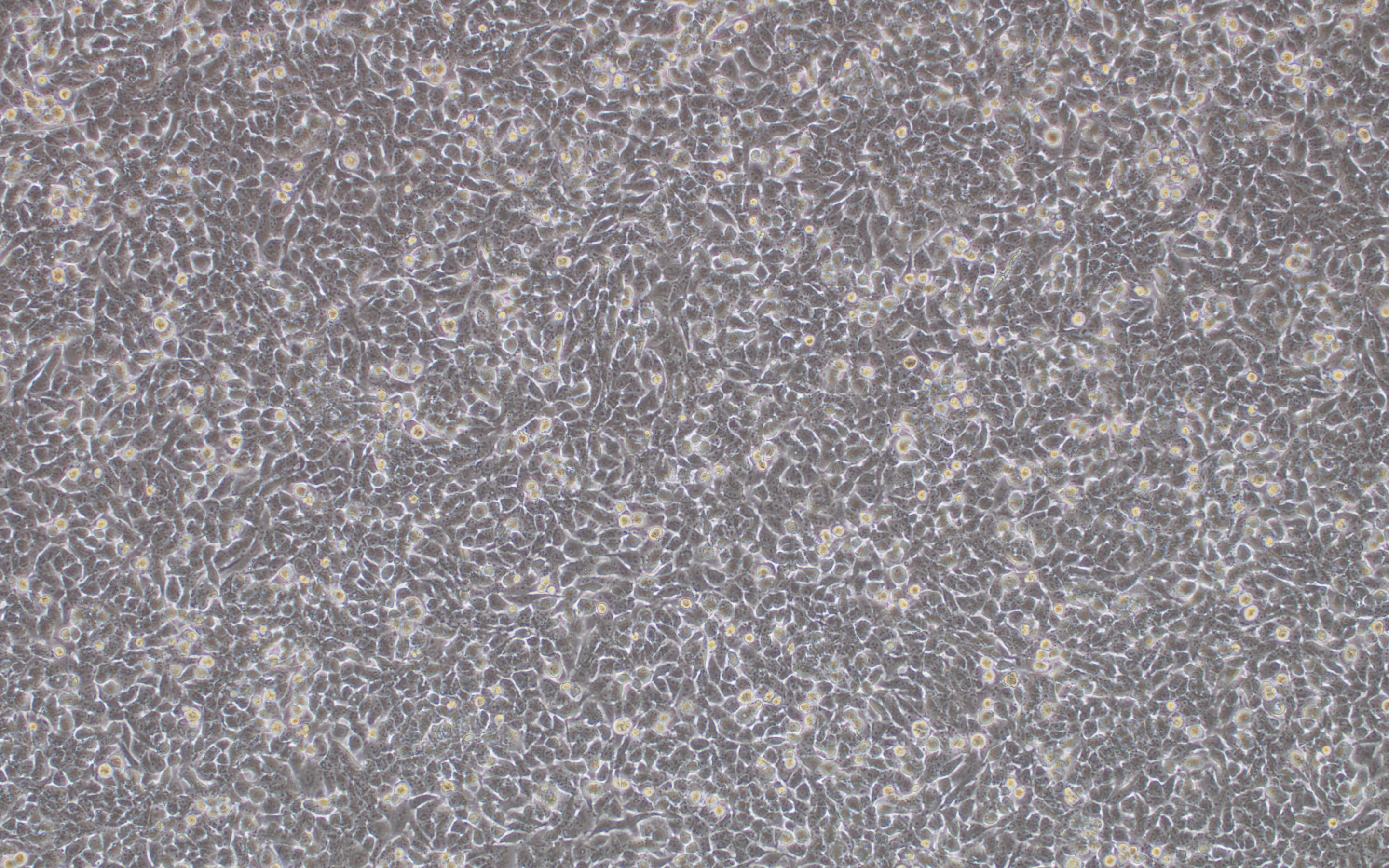 Adenovirus Packaging Services | VectorBuilder